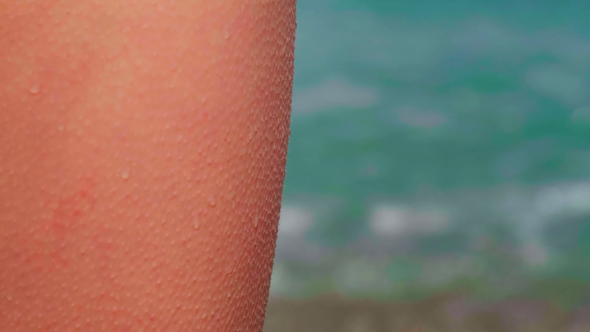 Caucasian Woman Having Chills On Skin On Stock Footage SBV-352053258 ...