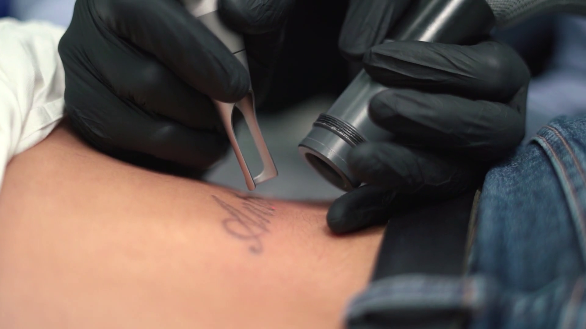 Girl Erasing Tattoo Of Exboyfriend Name Stock Footage SBV-351719720 ...