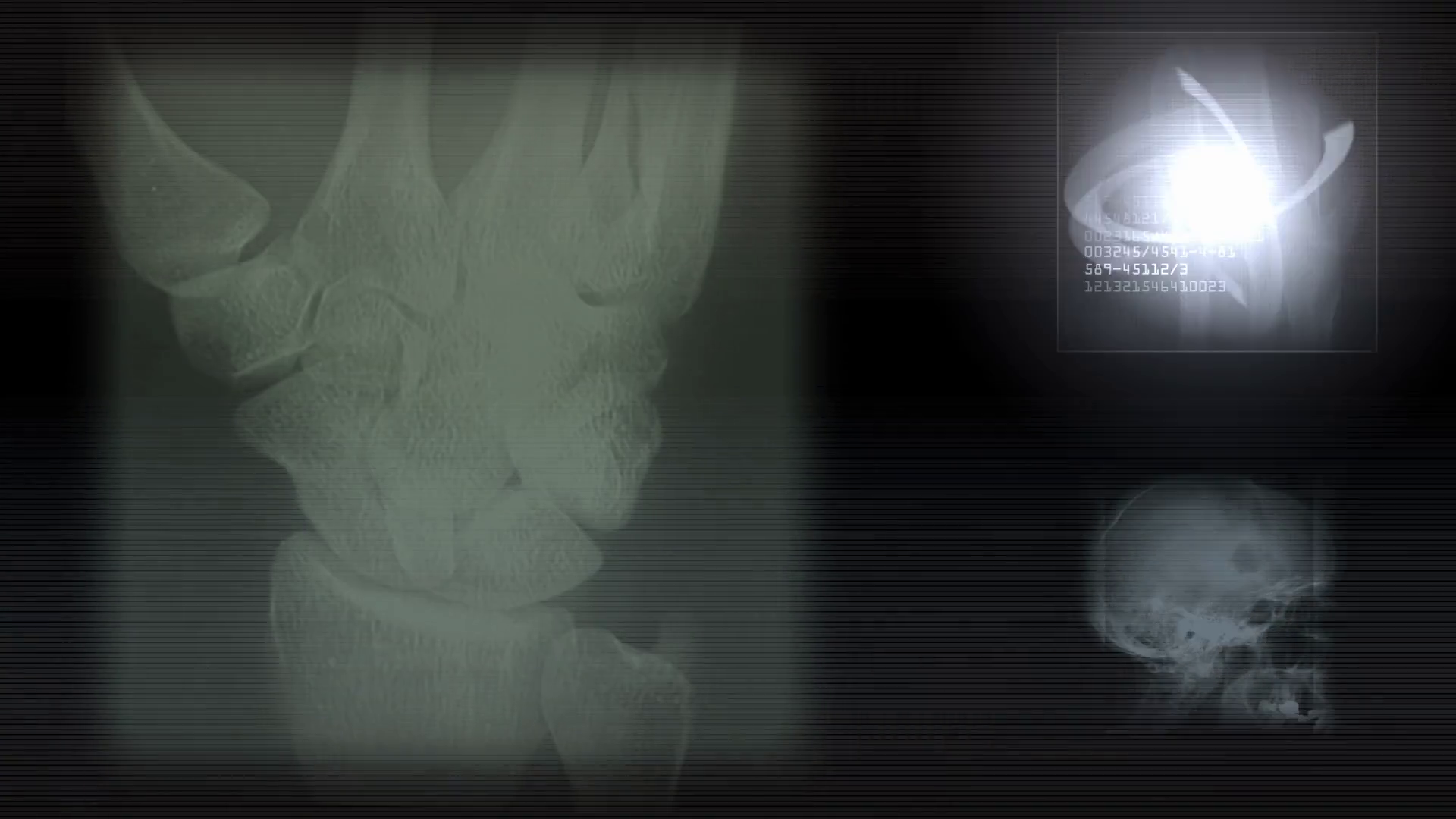 Medical Xray Scan Overlay Radiology Imaging Stock Motion Graphics SBV ...
