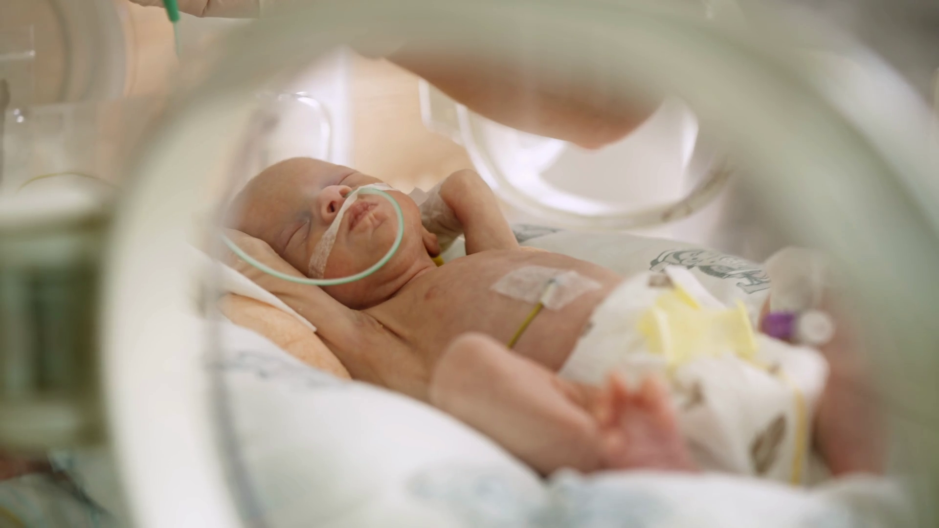 Feeding Premature Baby In Nicu Stock Footage SBV-352375753 - Storyblocks