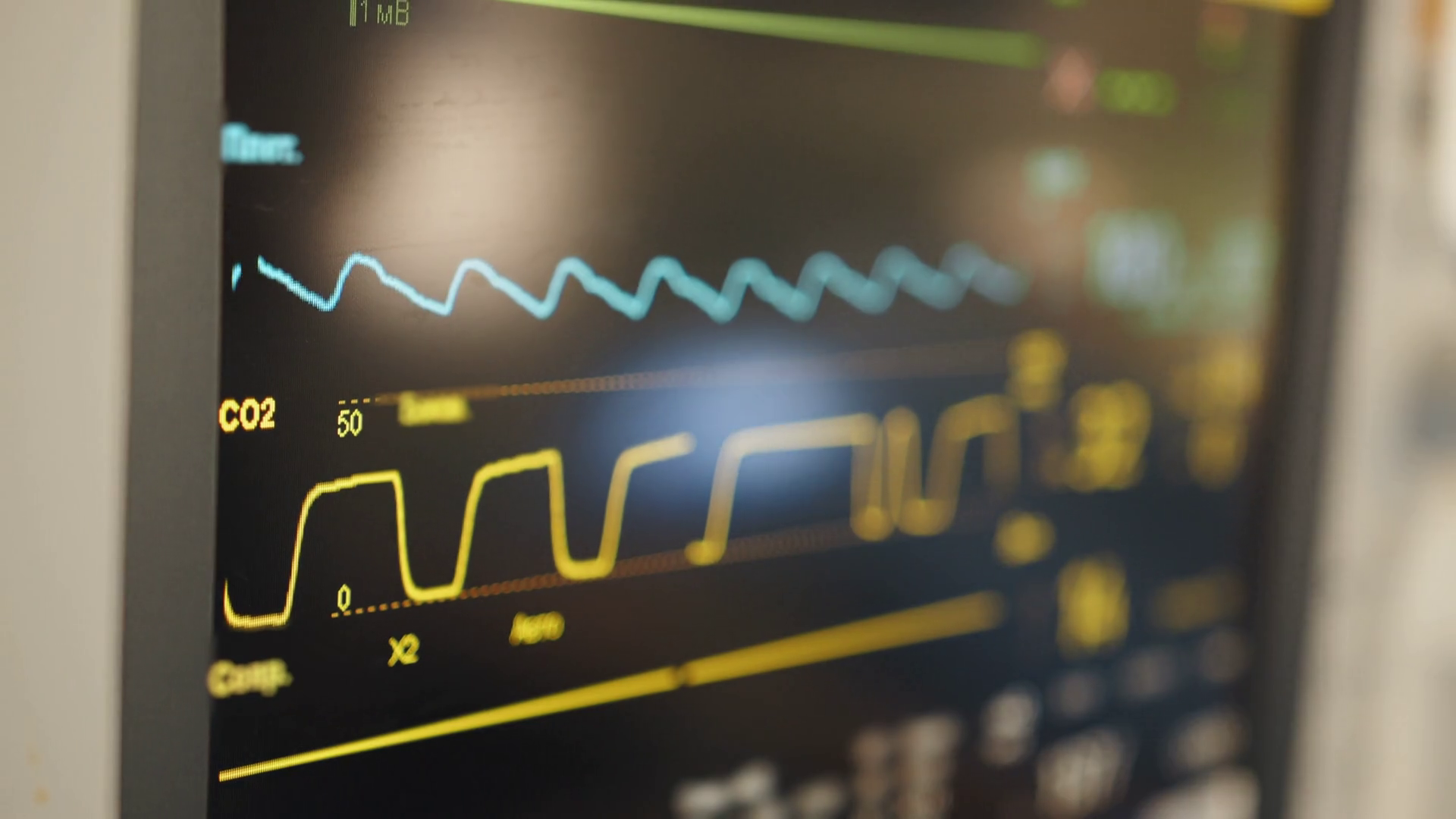 Heart Rate Monitor In Hospital Theater Stock Footage SBV-348507313 ...