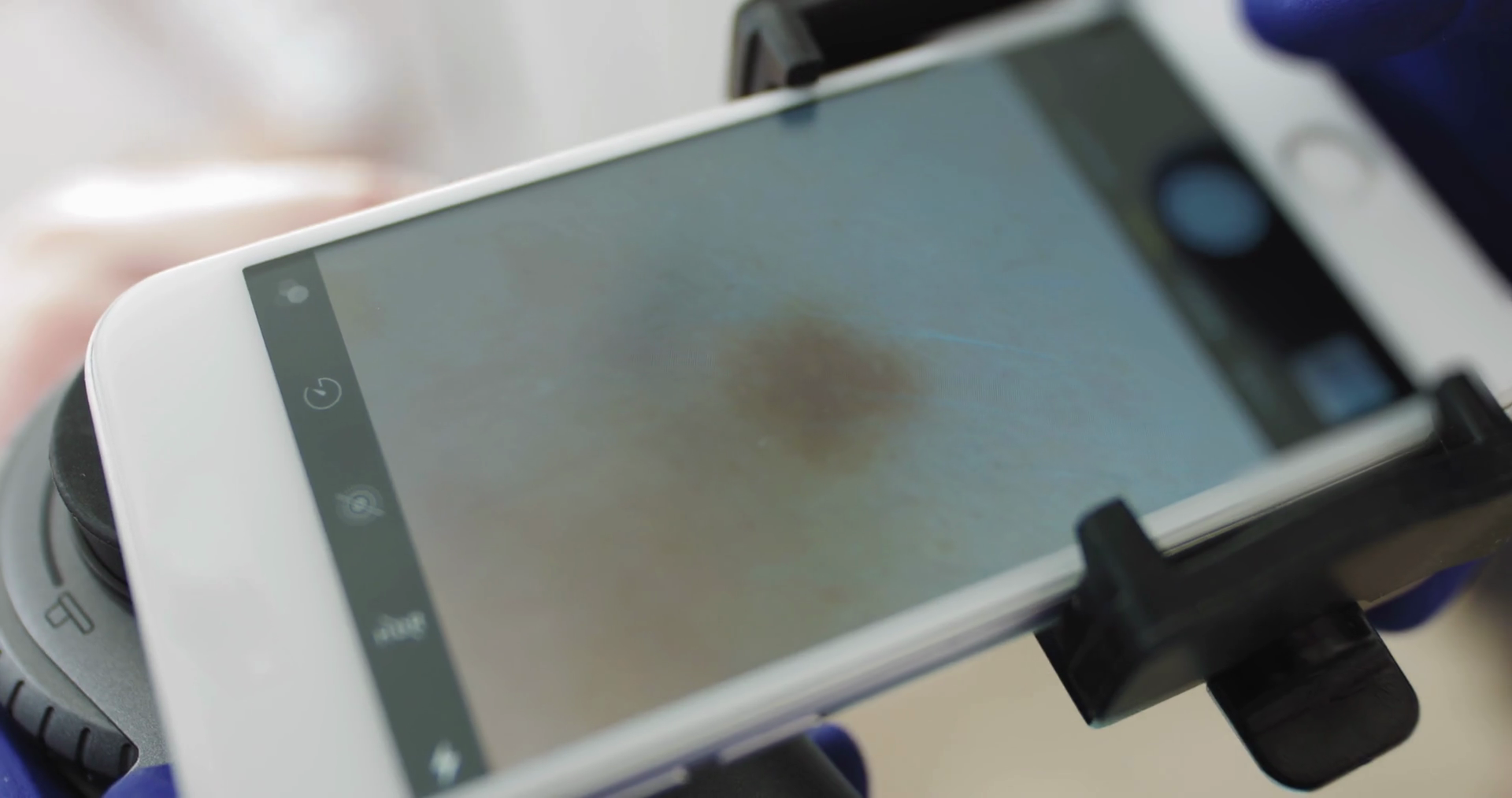 Professional Doctor Dermatologist Research Stock Footage SBV-348523639 ...