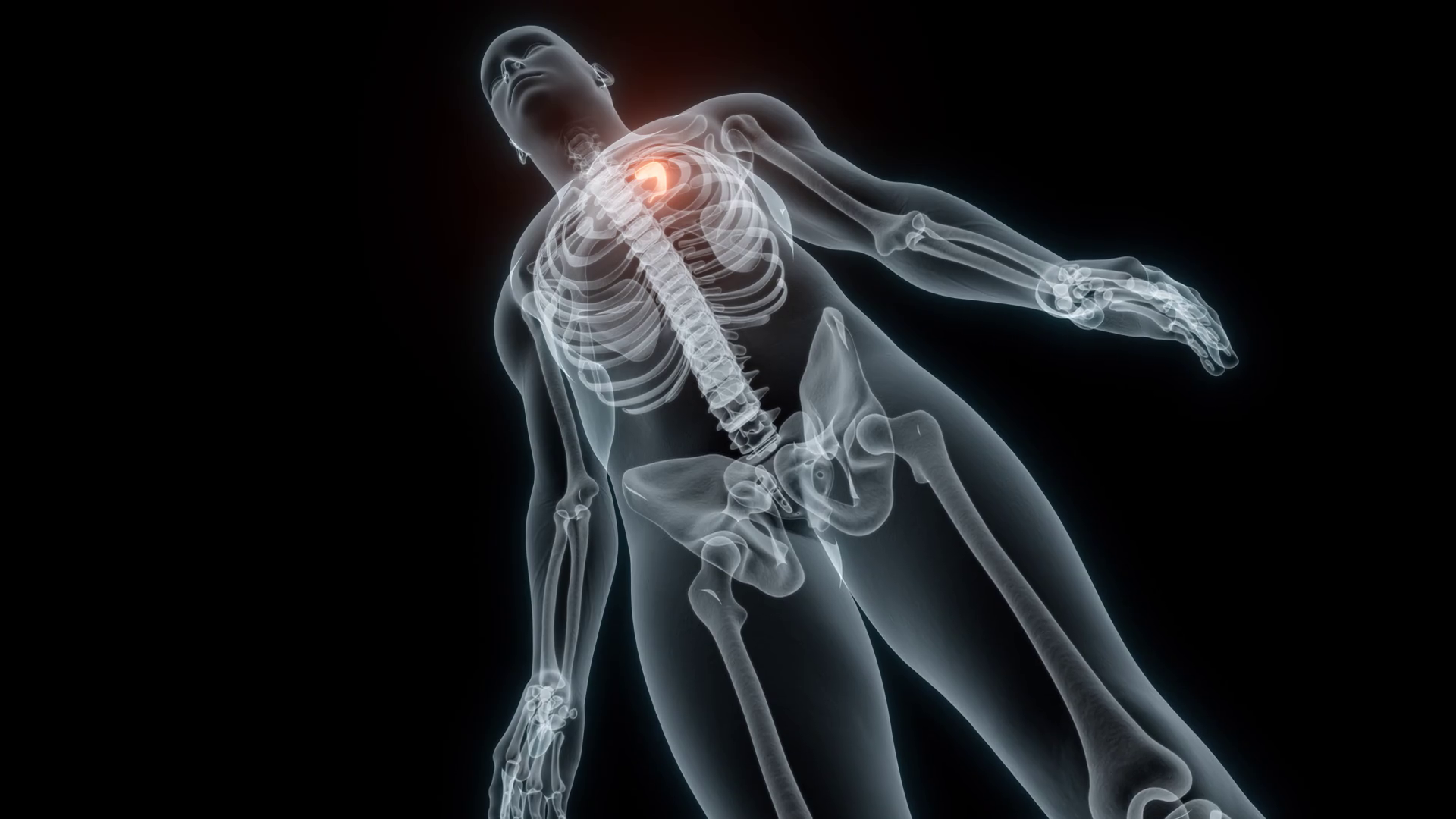 3d Rendering Of Medical Animation Of Rib Stock Footage SBV-347463348 ...