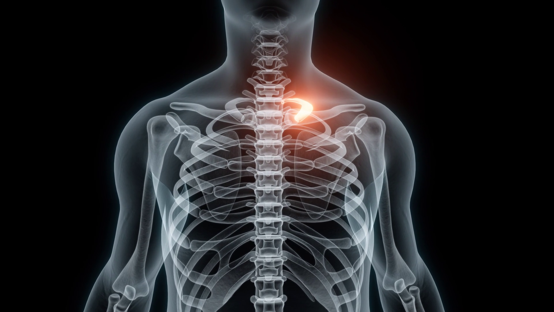 3d Rendering Of Medical Animation Of Rib Stock Footage SBV-347463279 ...