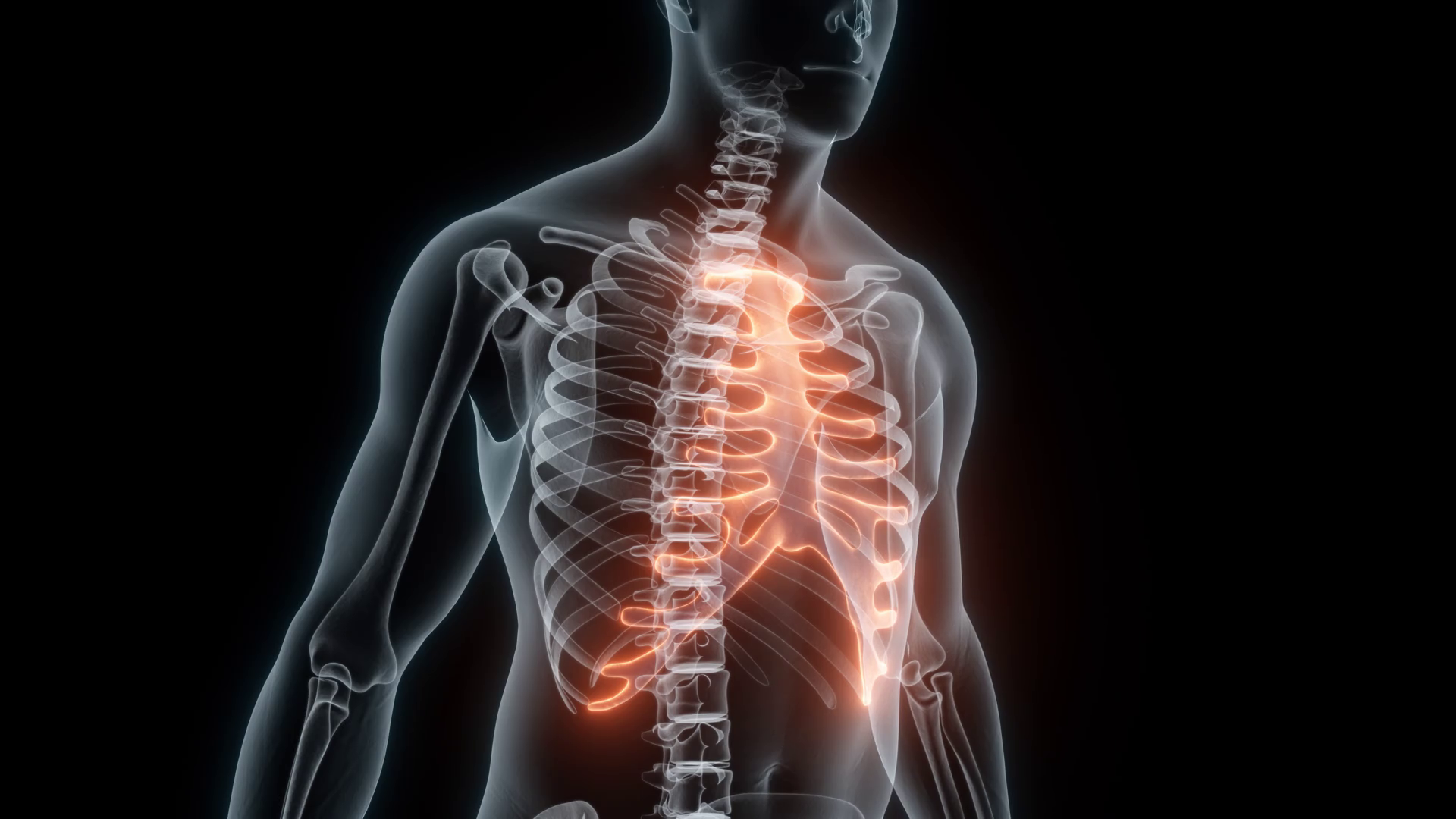 3d Rendering Of Medical Animation Of Rib Stock Footage SBV-347666543 ...