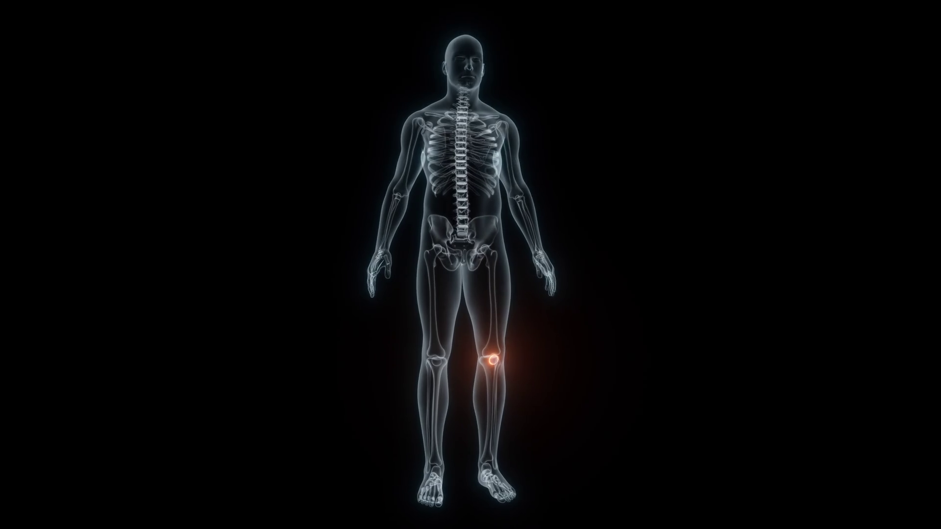 3d Rendering Of Medical Animation Of Knee Stock Motion Graphics SBV ...