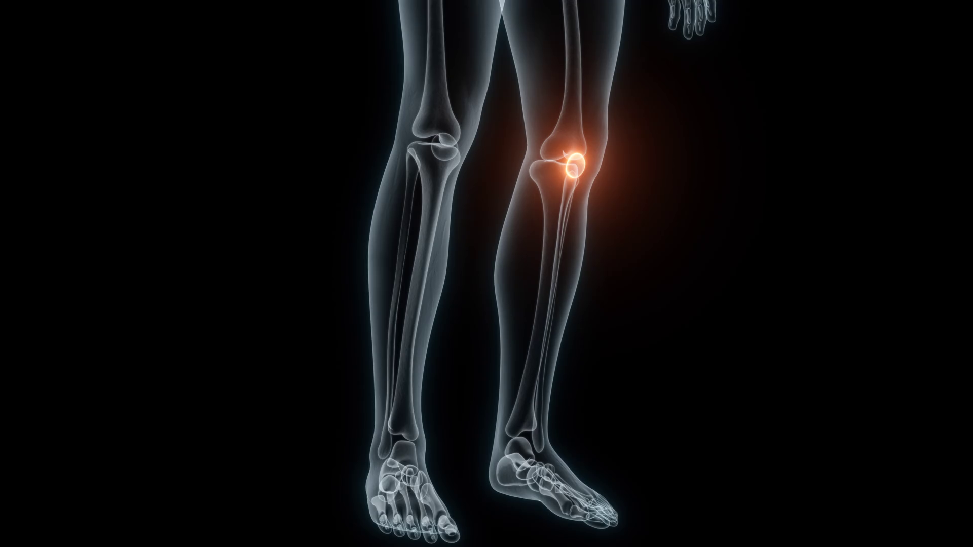 3d Rendering Of Medical Animation Of Knee Stock Motion Graphics SBV ...