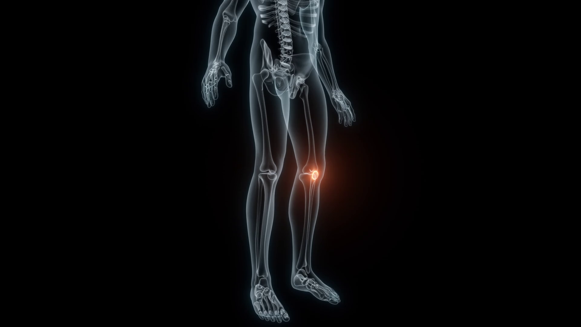 3d Rendering Of Medical Animation Of Knee Stock Motion Graphics SBV ...