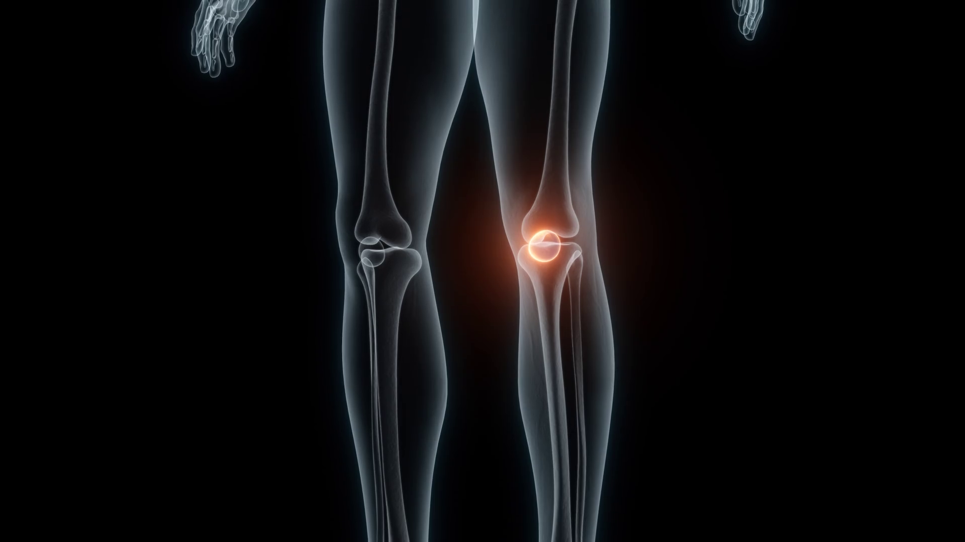 3d Rendering Of Medical Animation Of Knee Stock Motion Graphics SBV ...