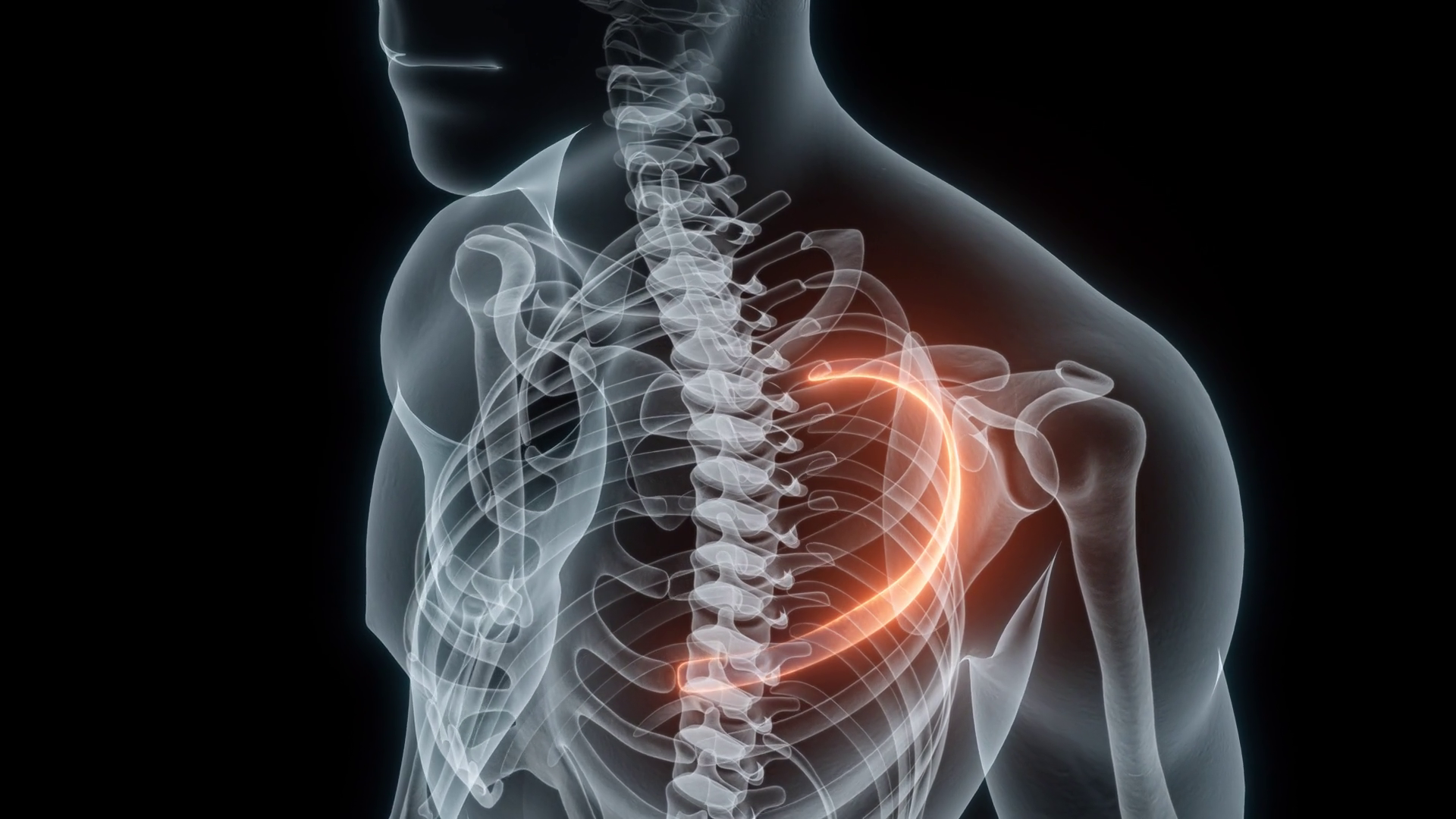 3d Rendering Of Medical Animation Of Rib Stock Footage SBV-347466910 ...