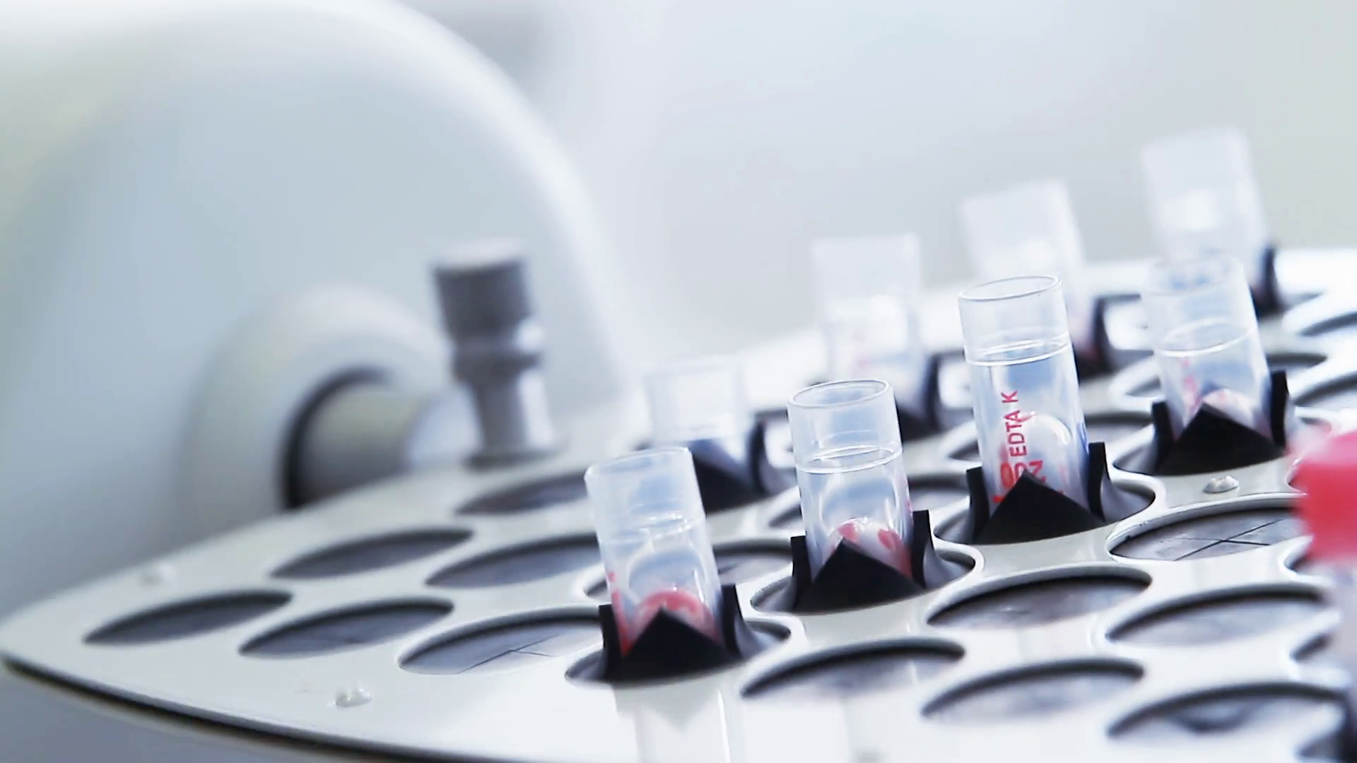 Blood Sample In Micro Tubes Stock Footage SBV-315083555 - Storyblocks