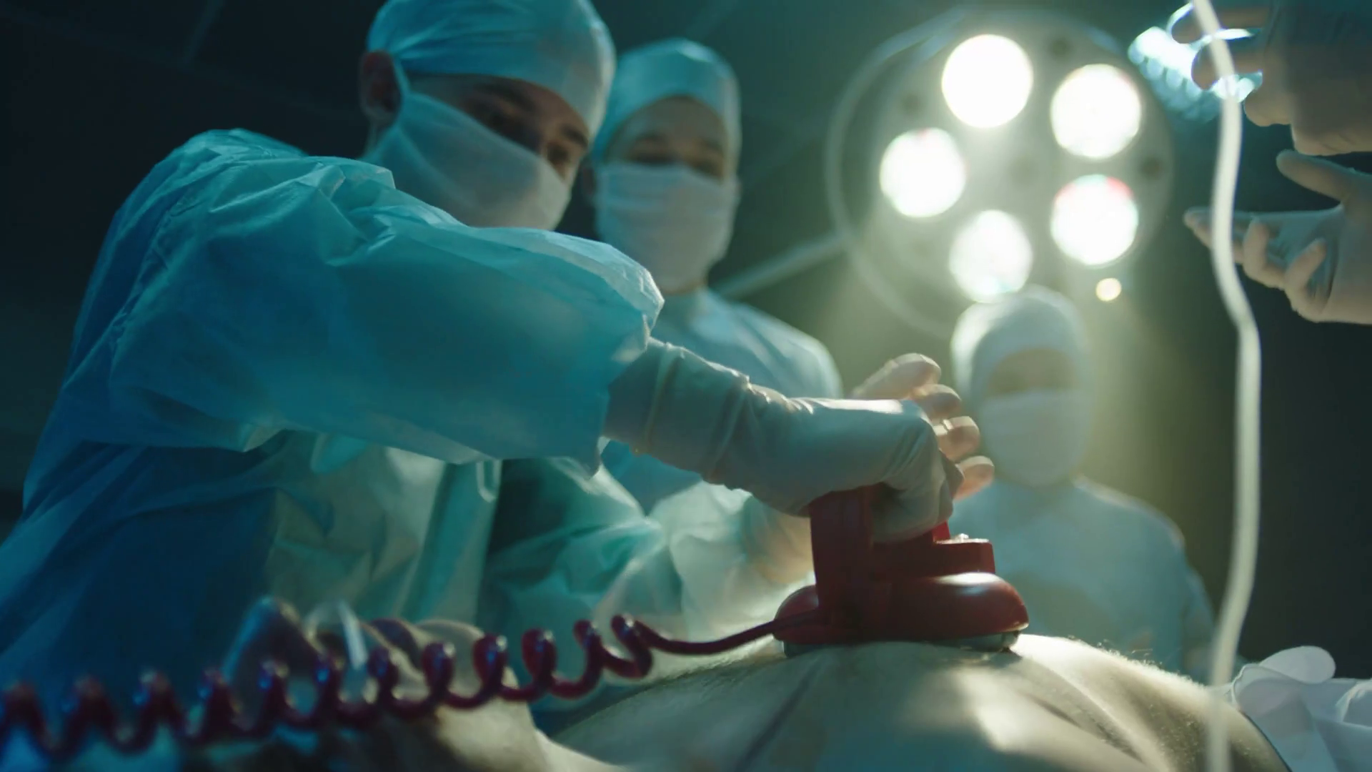 In Critical Surgery Stage Doctors Swiftly Stock Footage SBV-348477550 ...