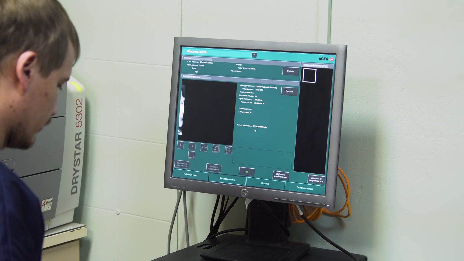 Doctor Behind Monitor In X-ray Room Looks At Stock Footage SBV ...