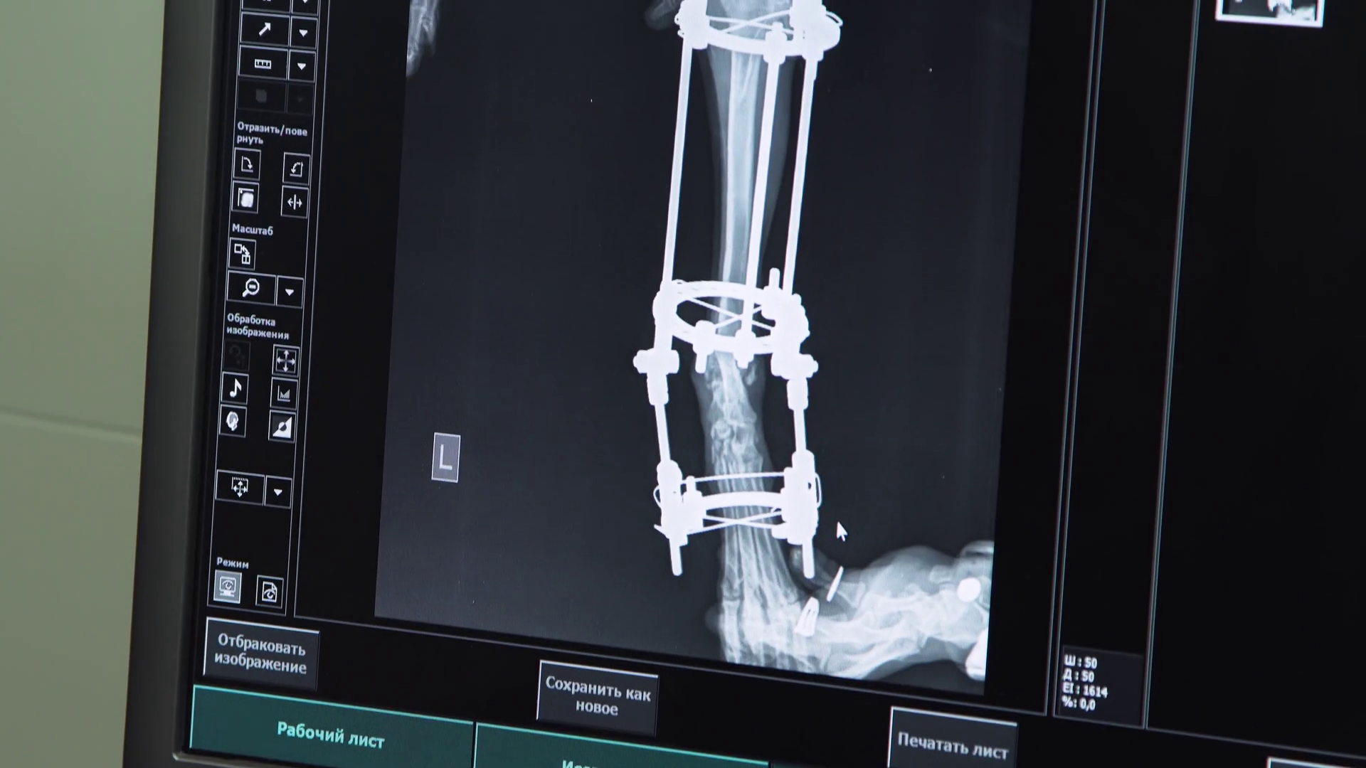 Veterinarian Looks At Monitor X-ray Image Of Stock Footage SBV ...