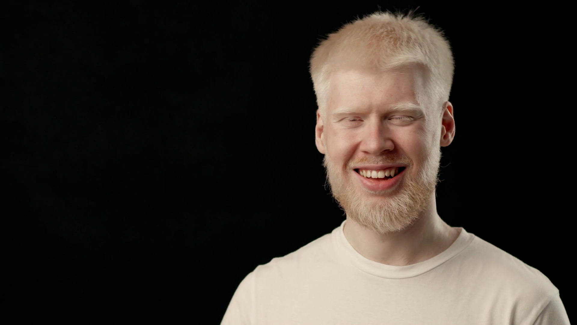 A Young Man With White Hair Pale Skin Is Stock Footage SBV-351739057 ...