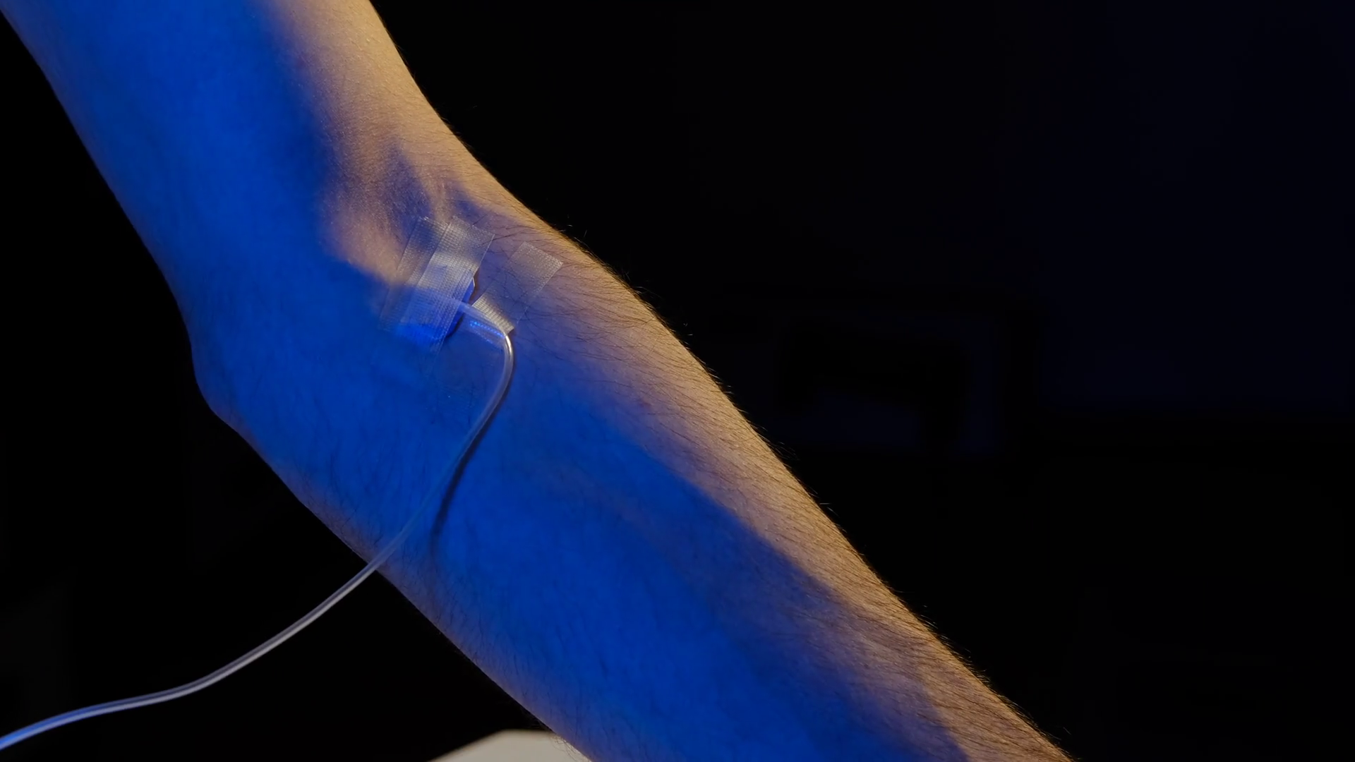 The Image Of Serum Attached To Arm In Blue Stock Footage SBV-347642097 ...