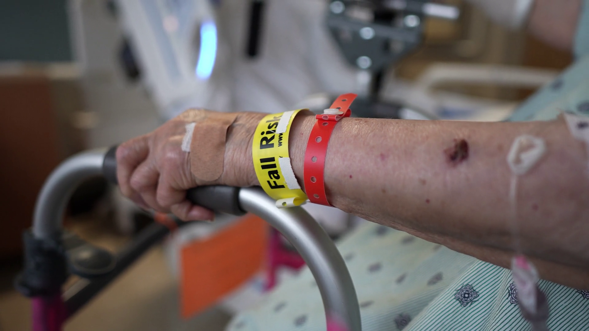 Closeup Of Fall Risk Wristband On Elderly Stock Footage SBV-352729652 ...