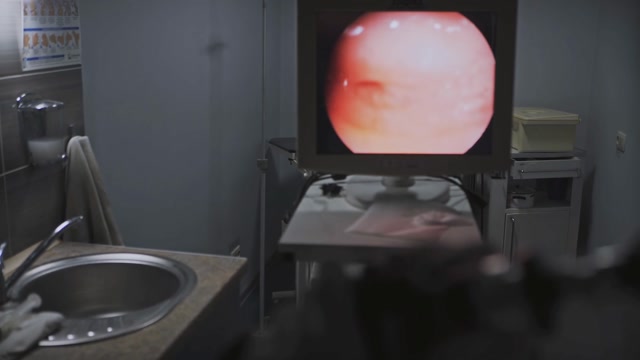 Colonoscopy Procedure Stock Footage: Royalty-Free Video Clips - Storyblocks