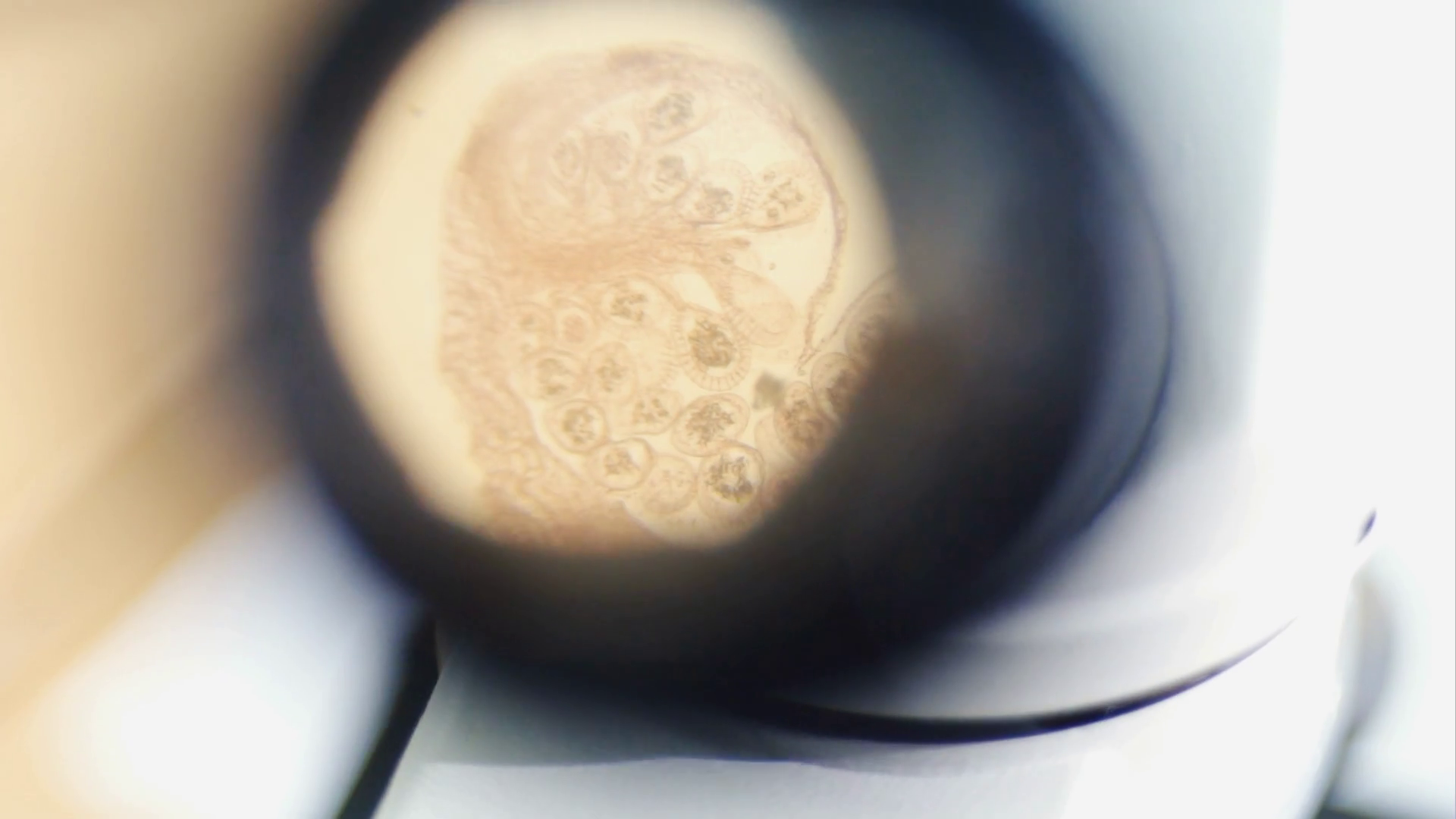 The Specimen Through Microscope Stock Footage SBV-347623111 - Storyblocks