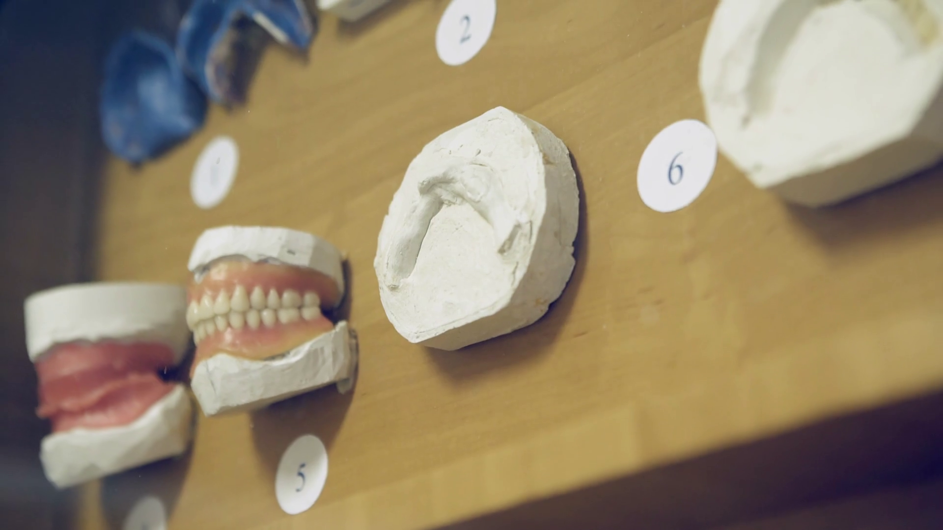 Cast Dental Models On Wooden Panel Stock Footage SBV-347628261 ...