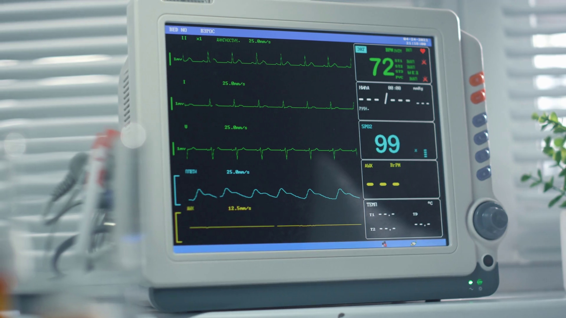 Heartbeat Monitor Screen Showing Pulse Vital Stock Footage SBV ...