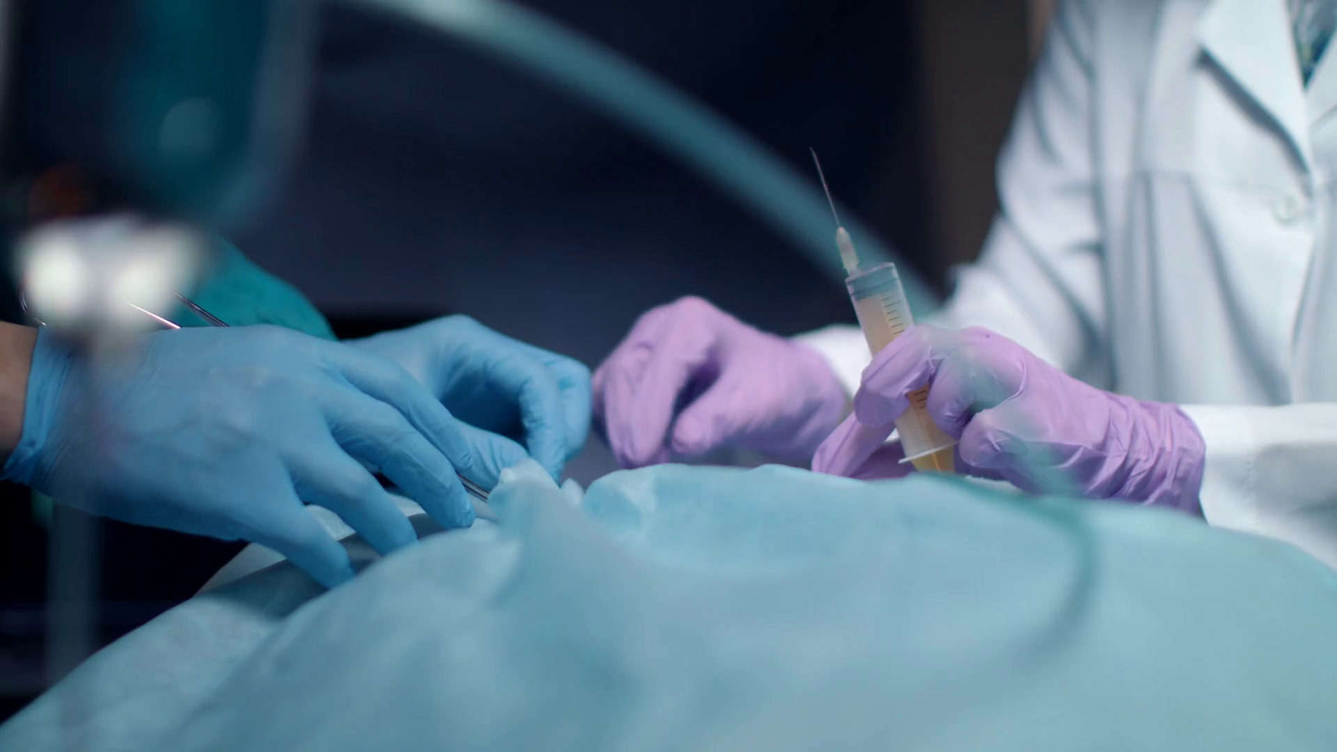Surgeon Operating Process Close Up Of Stock Footage SBV-327247113 ...