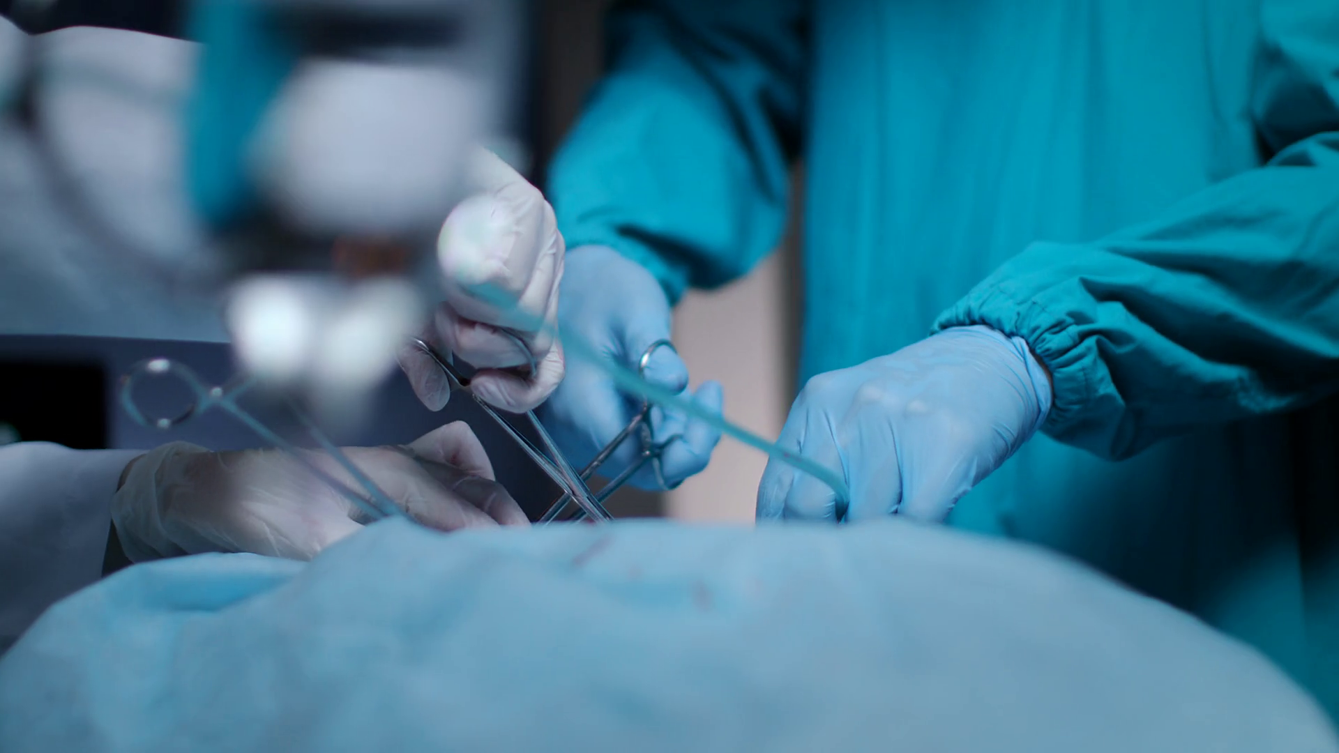 Surgeons Operating Process Close Up Of Stock Footage SBV-327200521 ...