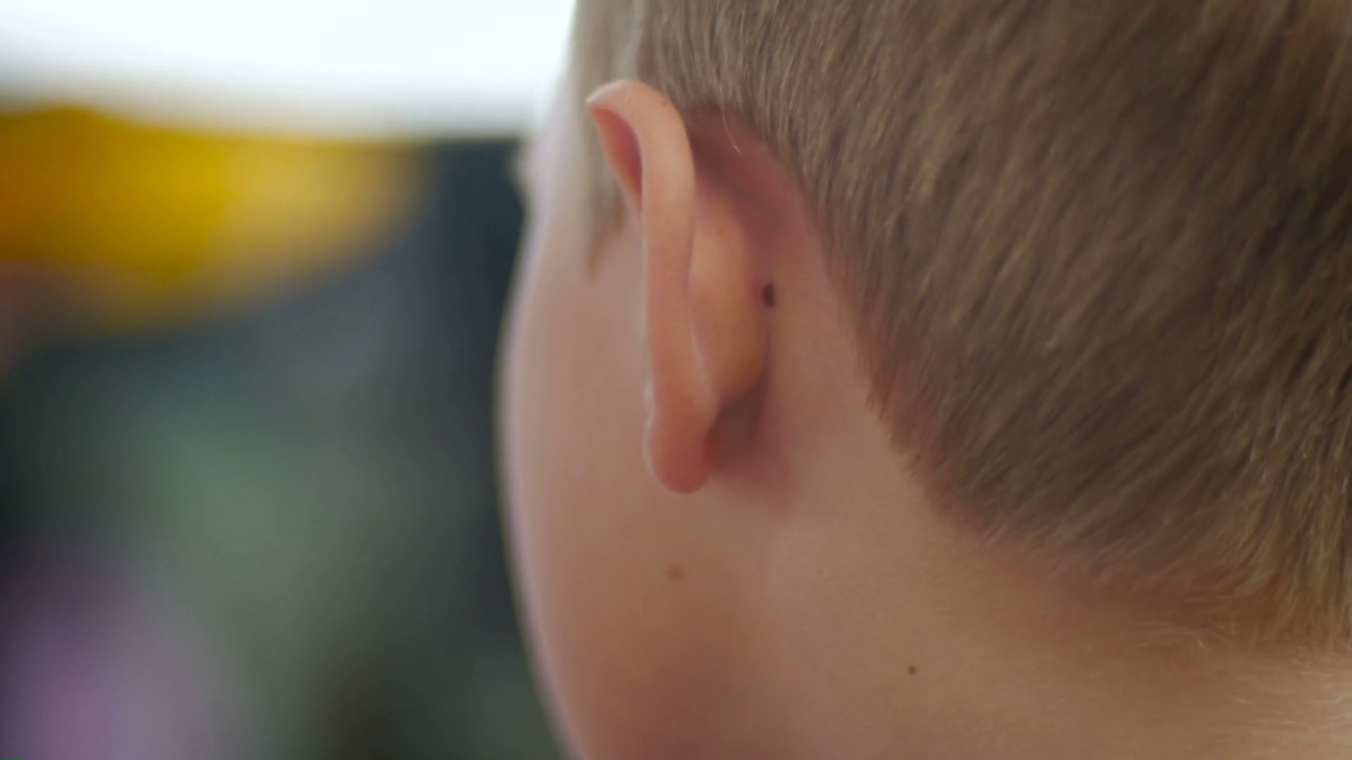 Close-up Of Young Child With Small Scar Stock Footage SBV-309806329 ...