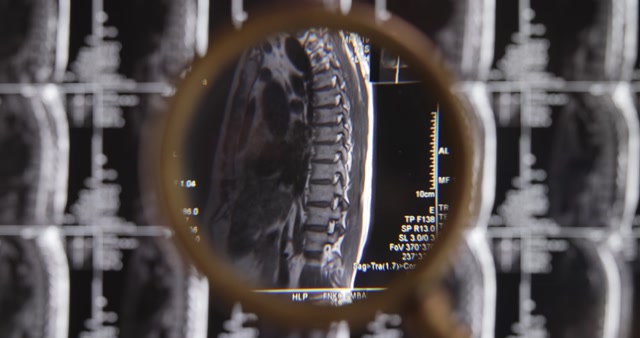 Scan Of Spine Stock Footage: Royalty-Free Video Clips - Storyblocks