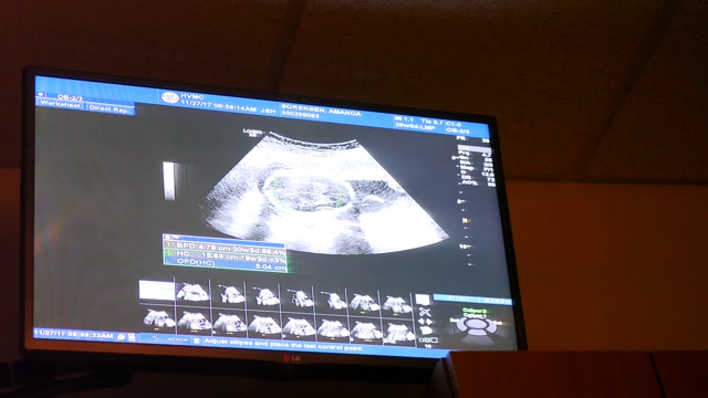 Girl Voice Saying Hi Baby Stock Footage: Royalty-Free Video Clips ...