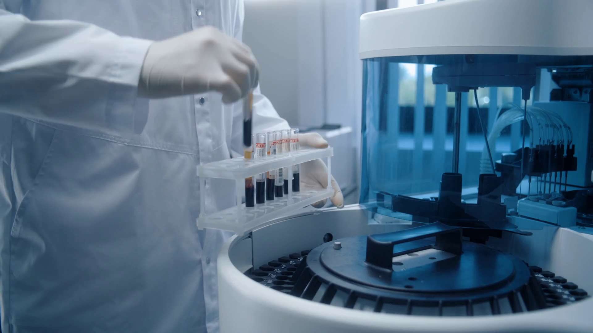 Male Chemist Puts Blood Samples From Tube Stock Footage SBV-348801597 ...