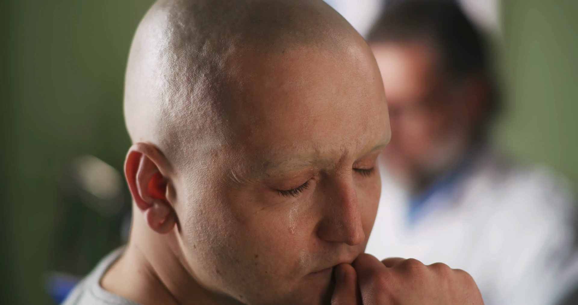 Rack Focus Of Sad Bald Male Patient With Stock Footage SBV-346405506 ...