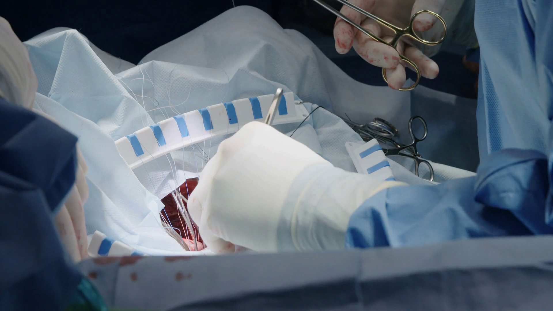 UAE Observes World Heart Day with Focus on Cardio Health