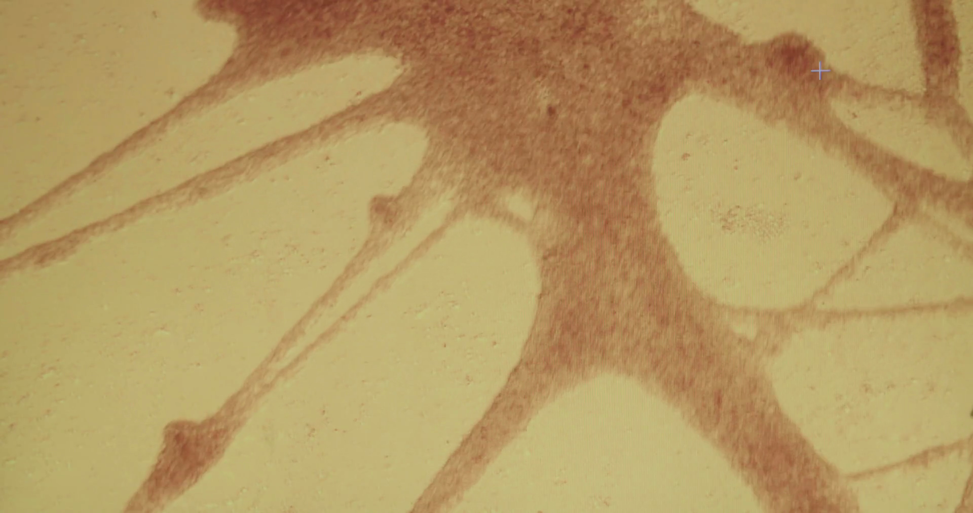 Heart Tissue Cells Under Microscope Stock Footage SBV-315872134 ...