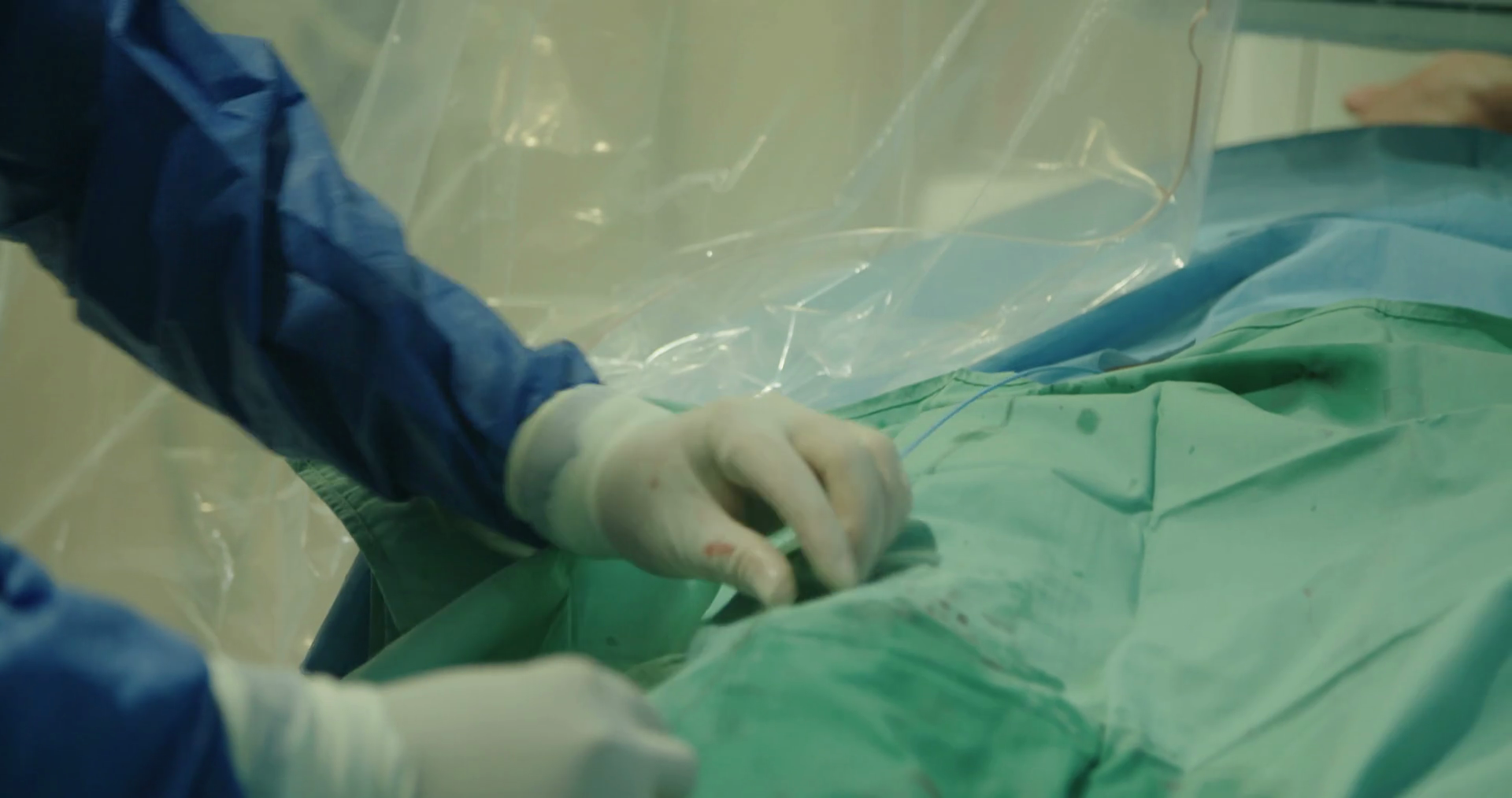 Surgeons Inserting Catheter During Cardiac Stock Footage SBV-315869921 ...