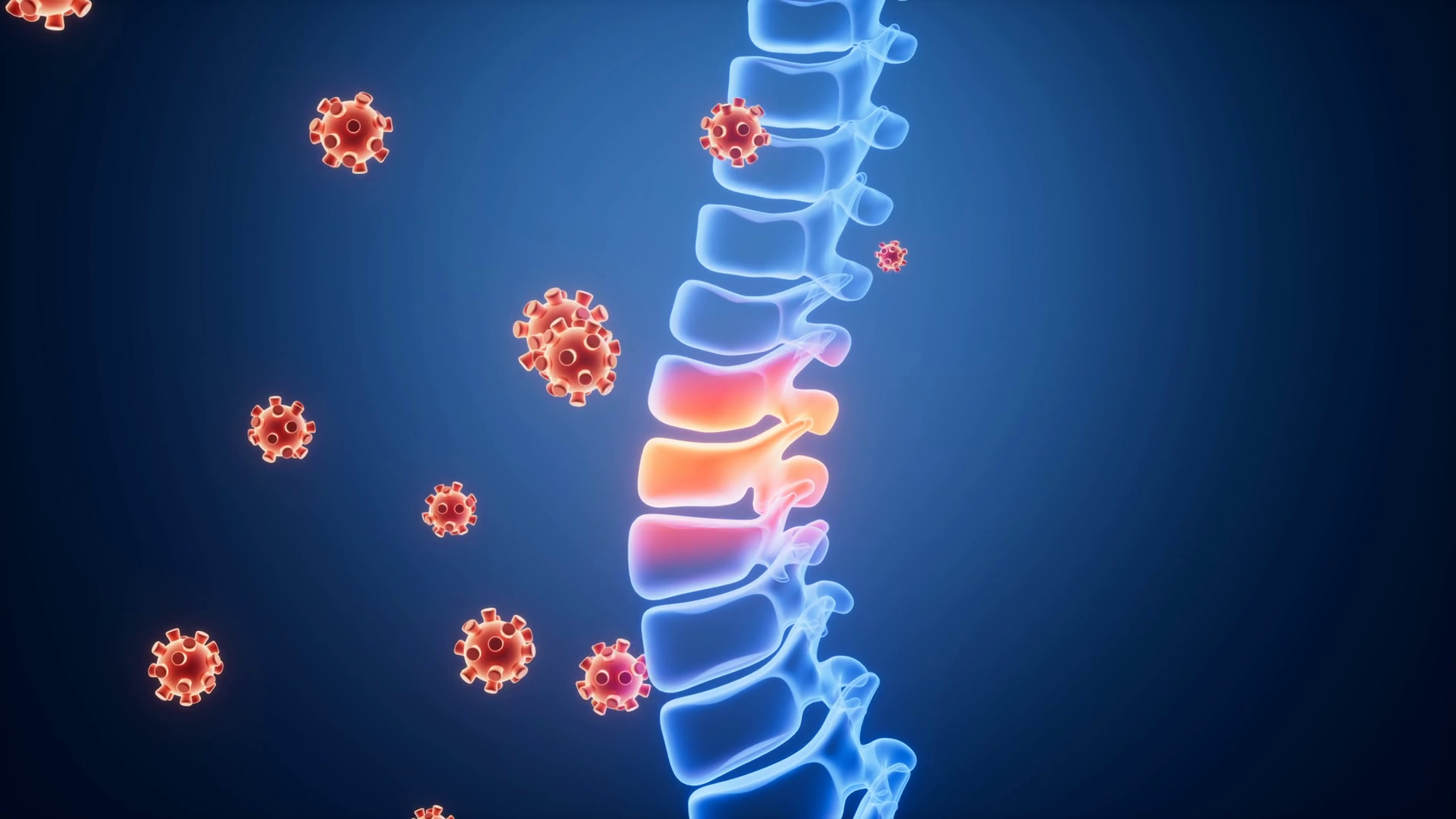 Human Spine Inflammation Viral Infection 3d Stock Motion Graphics SBV ...