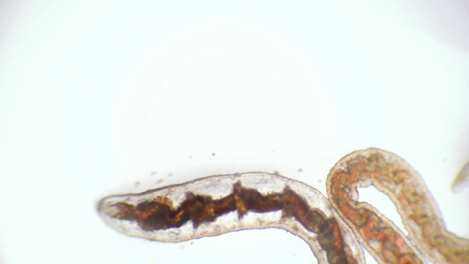 A Microscopic View Of Transparent Worm Stock Footage SBV-352428953 ...