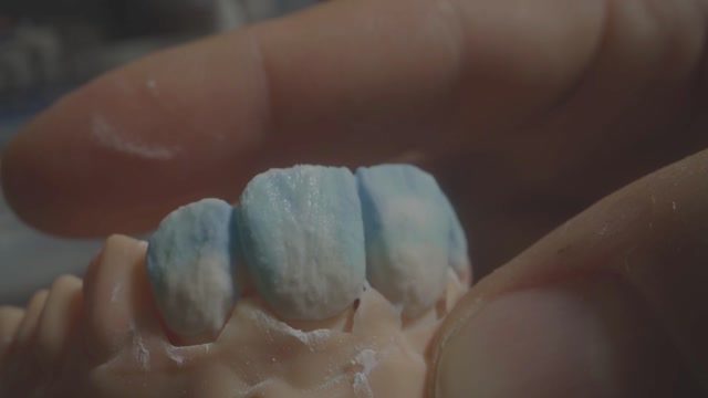 Human Body Repair Stock Footage: Royalty-Free Video Clips - Storyblocks