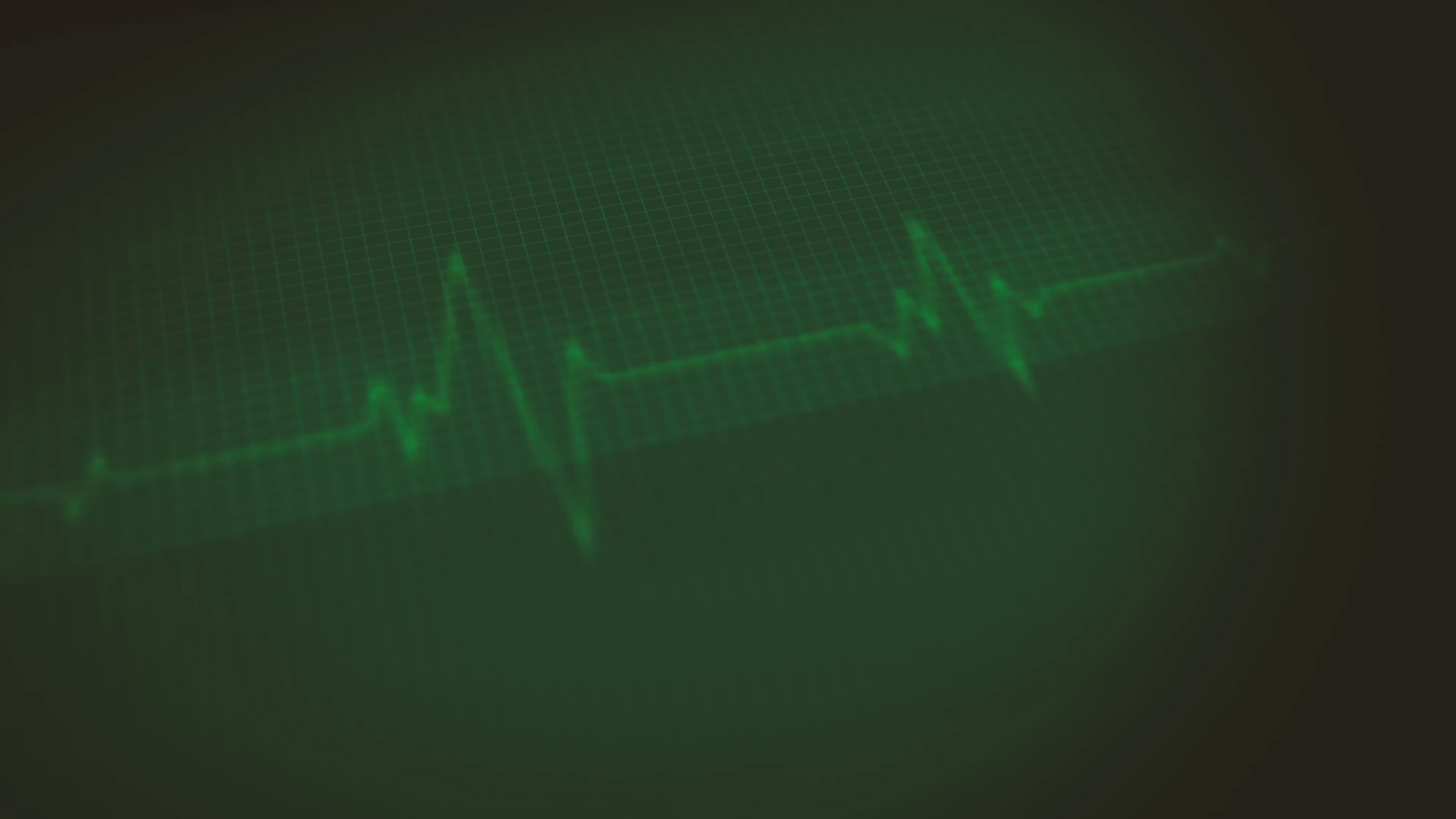 Medical Heart Pulsation Wave Signal Stock Motion Graphics SBV-348393908 ...