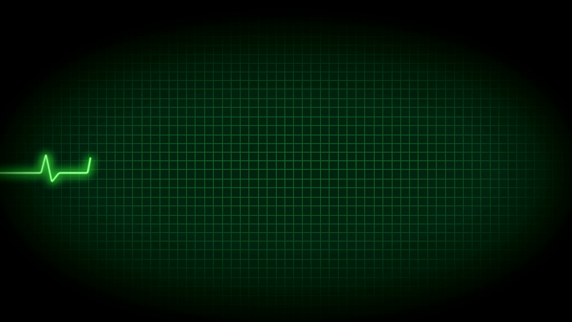 Abstract Animation Of Electrocardiogram In Stock Motion Graphics SBV ...