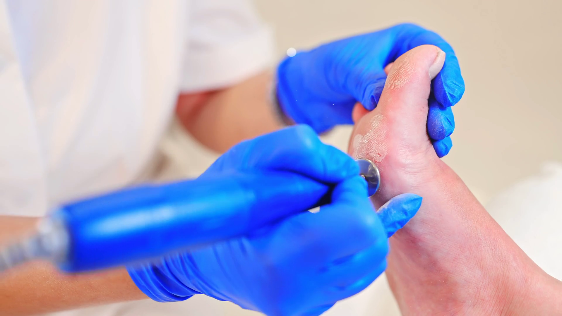 Podiatrist Doctor Using Grinding Machine Stock Footage SBV-347674871 ...