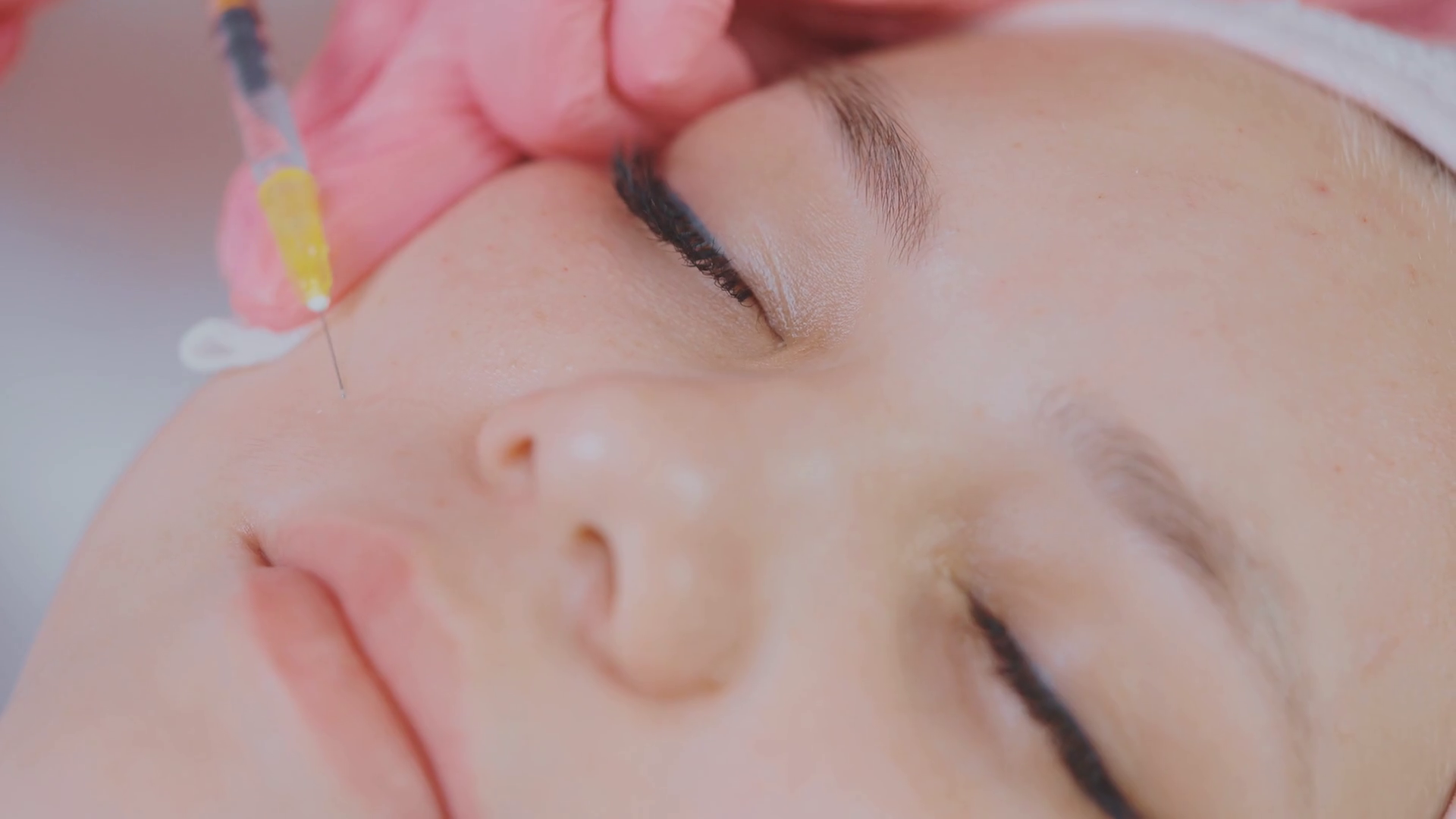 Close-up View Of Beauty Injection On Woman's Stock Footage SBV ...