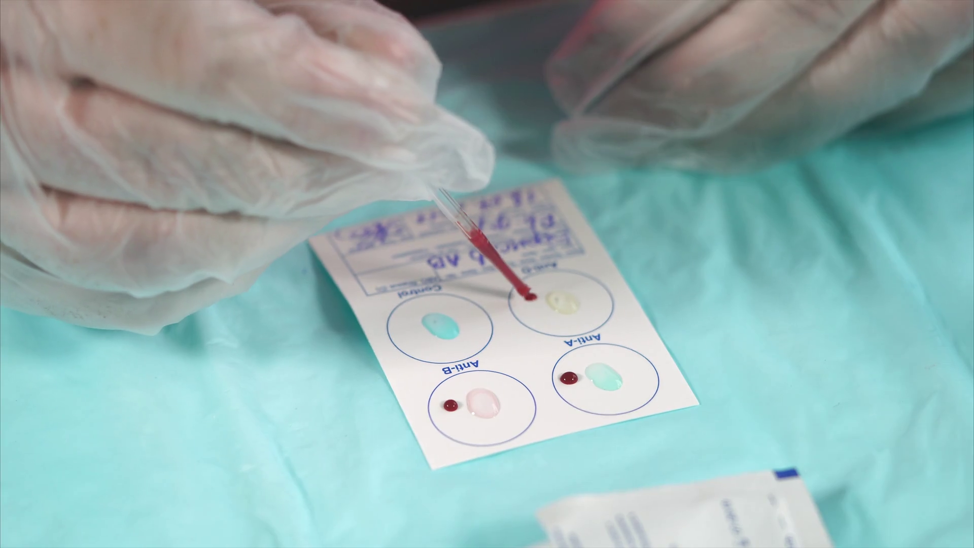 Medical Worker Applying Drops Of Blood On Stock Footage SBV-316714602 ...