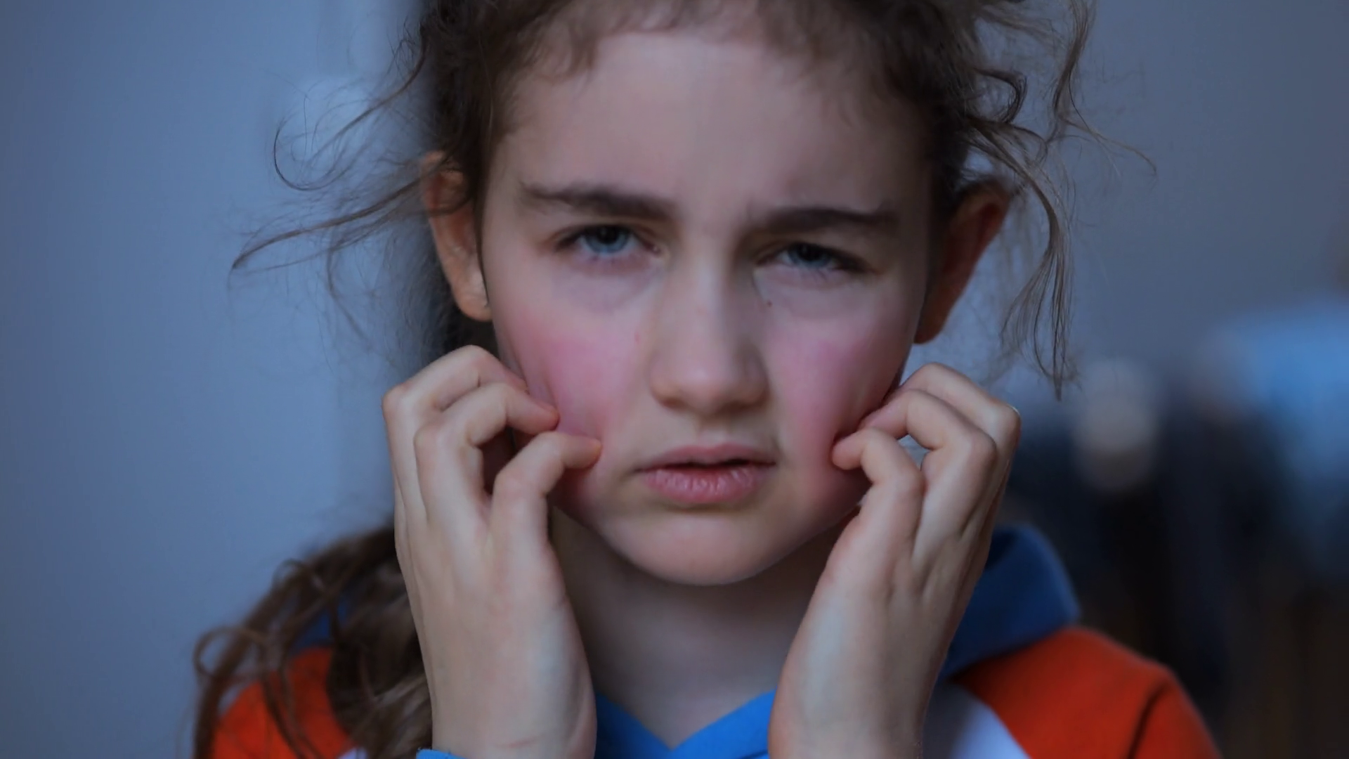 Girl Has Dry Red Skin Scratching Face Child Stock Footage SBV-353150379 ...