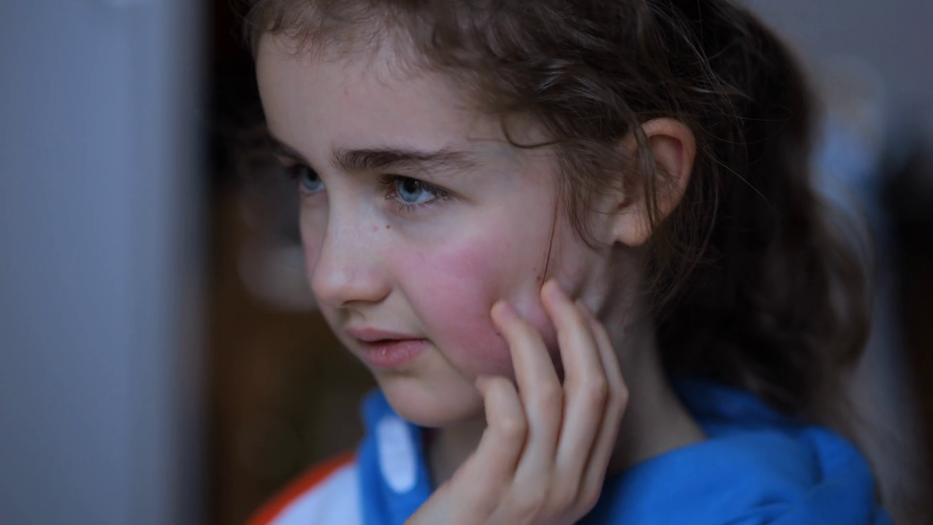 Girl Has Dry Red Skin Scratching Face Child Stock Footage SBV-353428838 ...
