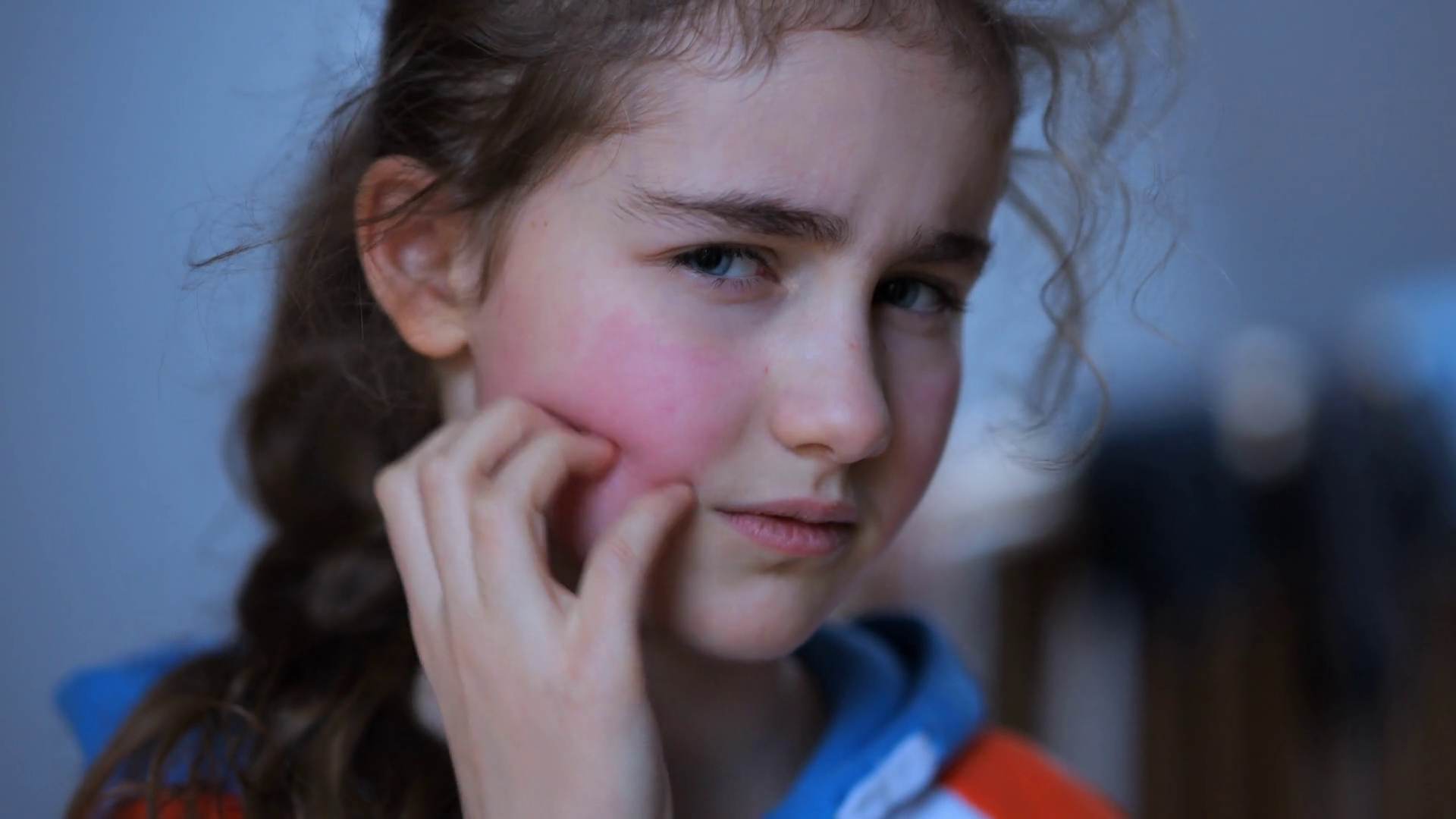 Girl Has Dry Red Skin Scratching Face Child Stock Footage SBV-352854904 ...