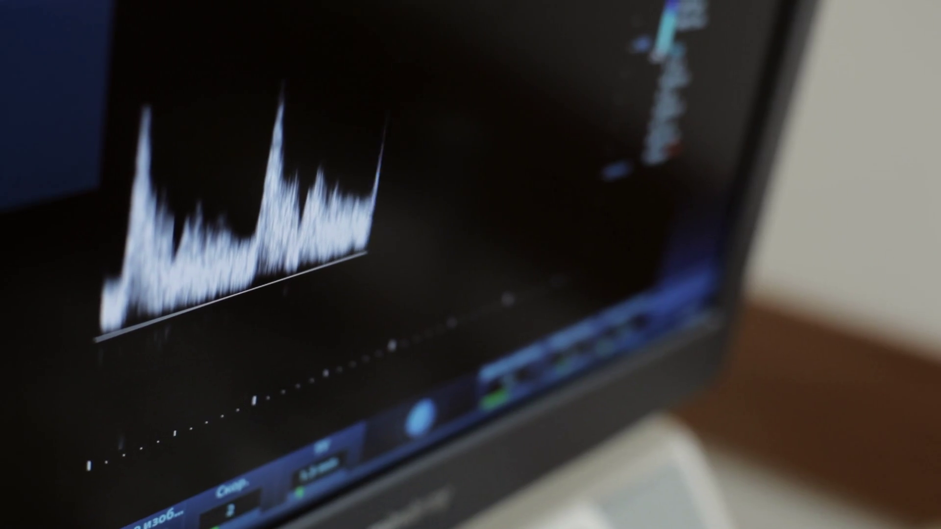 Ultrasonic Scanner Screen Doctor Scanning Stock Footage SBV-309630316 ...