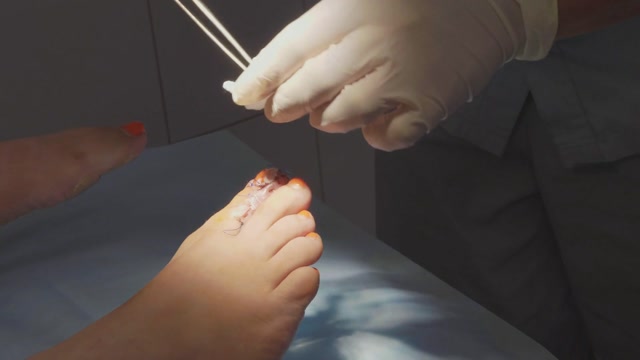 Foot Pain 3d Stock Footage: Royalty-Free Video Clips - Storyblocks
